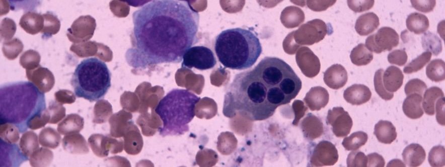 Role of chromatin remodelling complexes in development | Biocev