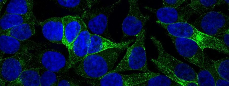 BIOCEV research teams will participate in the Czech-US program INTER ...