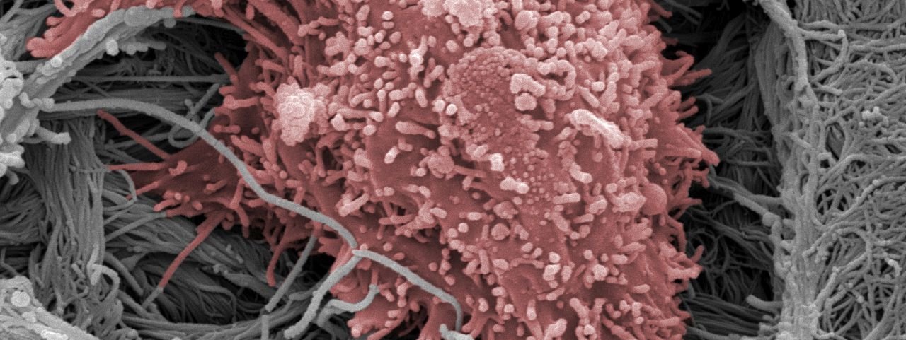 New method for imaging live tumor cells allows analysis of their ...