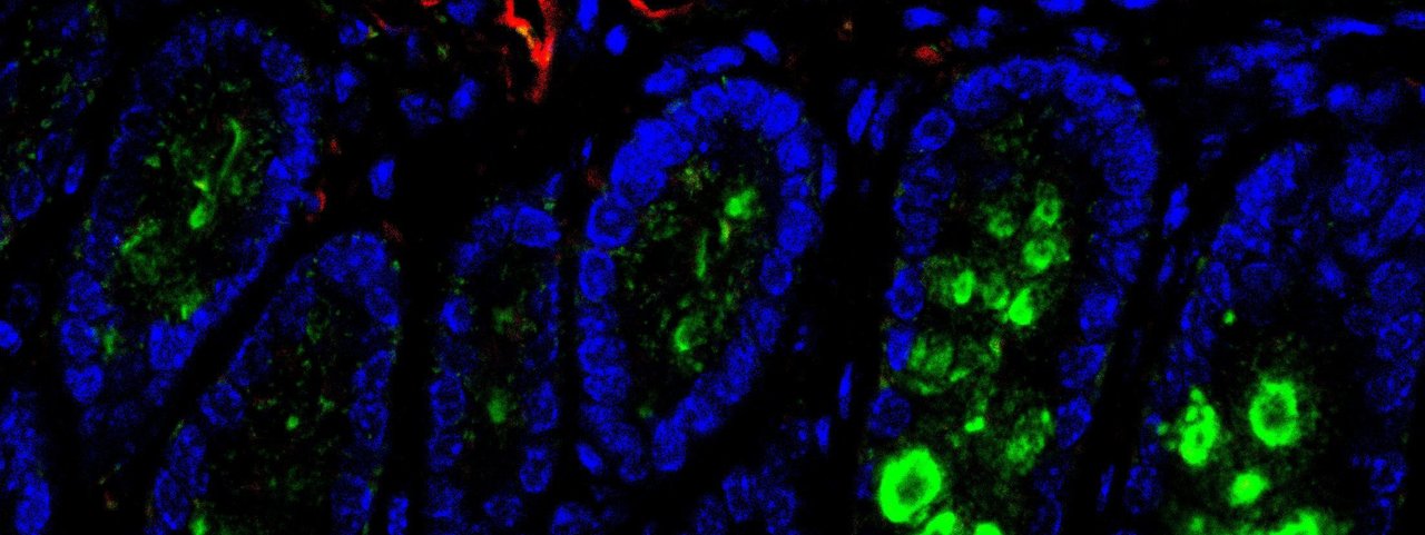 The head of the youngest research group at BIOCEV has received a ...