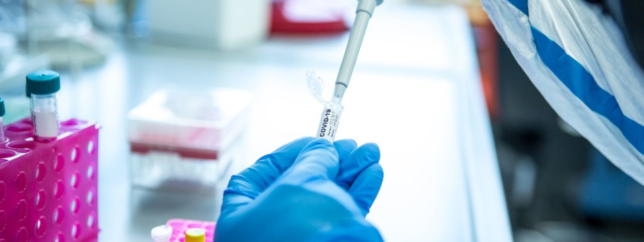 A new laboratory for SARS-CoV-2 research is being established at BIOCEV ...