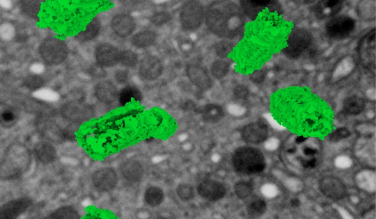 Imaging Methods | Biocev