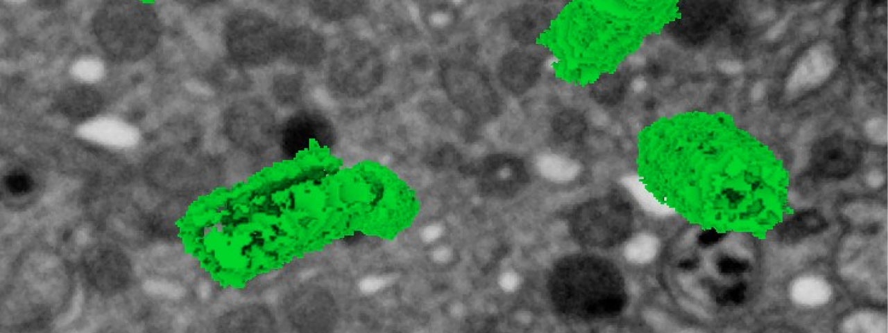 BIOCEV scientists help discover a mechanism that regulates the motility ...