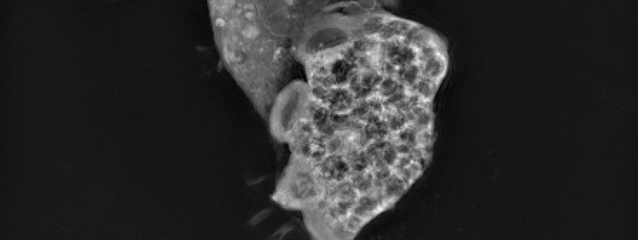 New weapons against 'brain-eating' and tropical diseases thanks to ...