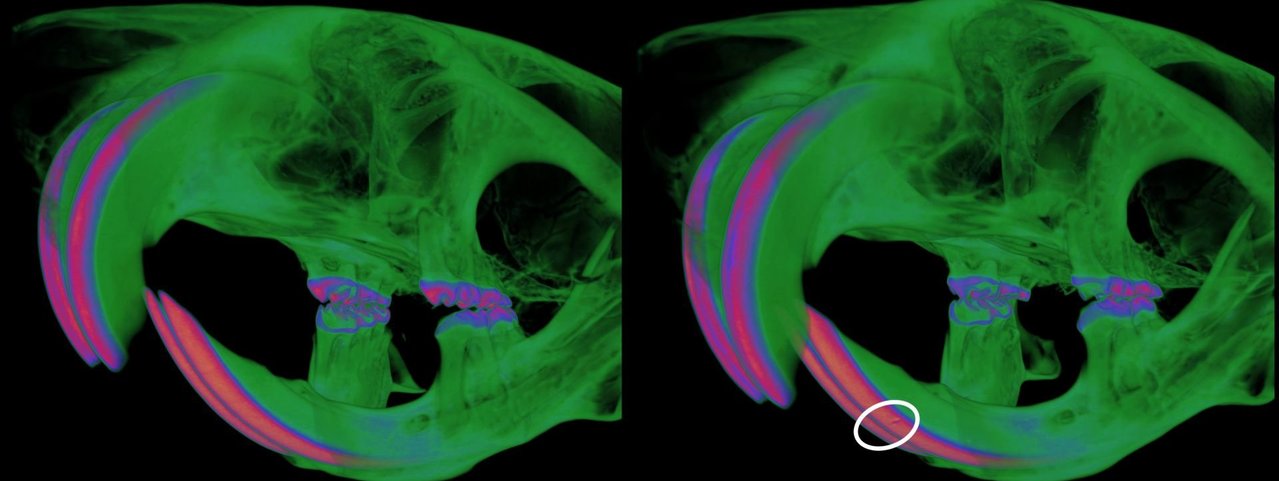 A link between autoimmune disorders and tooth enamel defects revealed ...