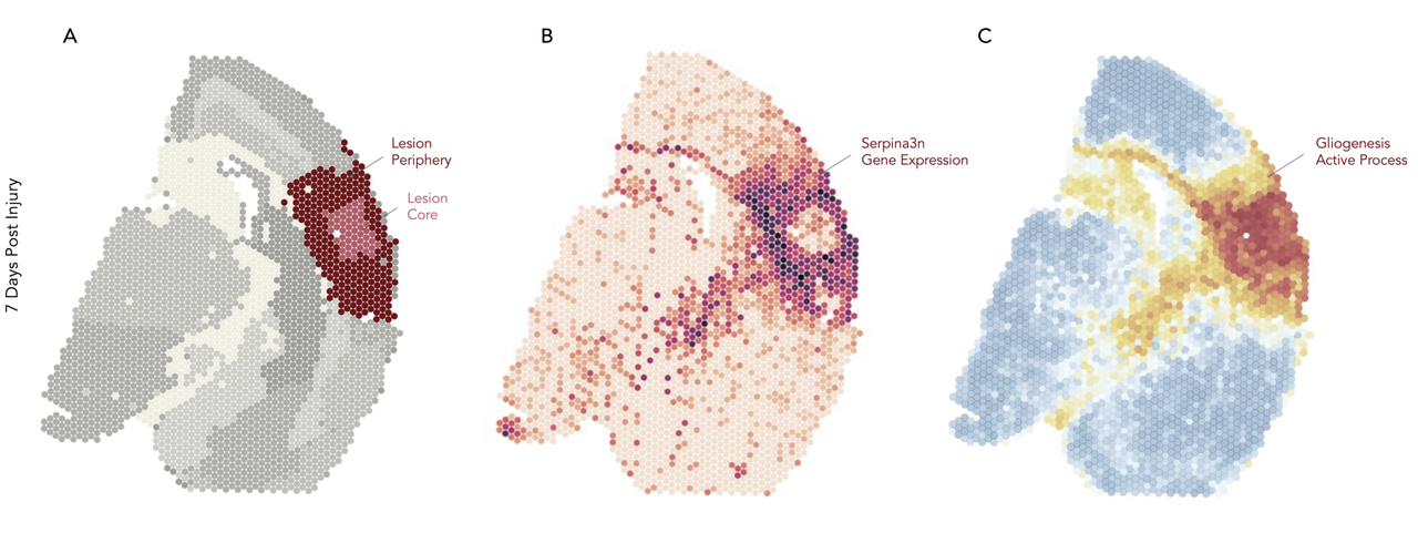 Groundbreaking study maps brain’s recovery process after stroke using ...